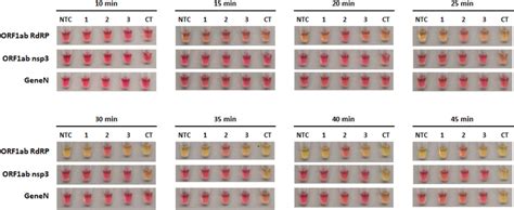 False Positive Testing Of Rt Lamp In Clinical Saliva Samples Rt Lamp