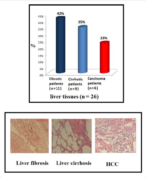 classification of liver tissue samples according to pathology