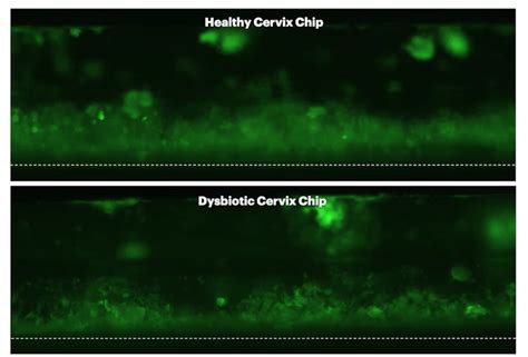 Wyss Institute Researchers Develop Cervix On A Chip A New Tool For