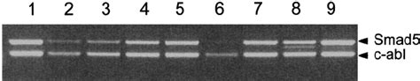 Rt Pcr Expression Analysis Of Human Smad5 In Various Cell Types Lane