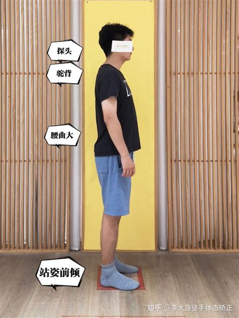 【教你全面评估体态】 知乎