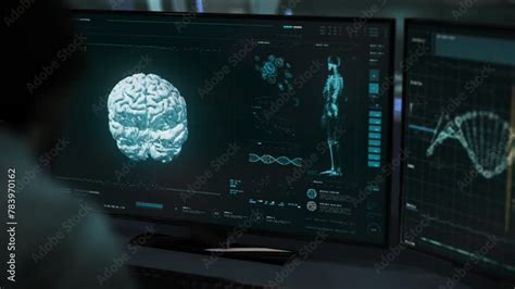 Vidéo Stock Medical Diagnosis System Is Scanning The Human Organs