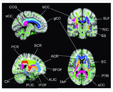 Frontiers Diffusion Tensor Imaging Revealed Microstructural 46 Off