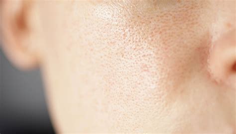 How To Reduce The Size Of Facial Pores Reviva Labs