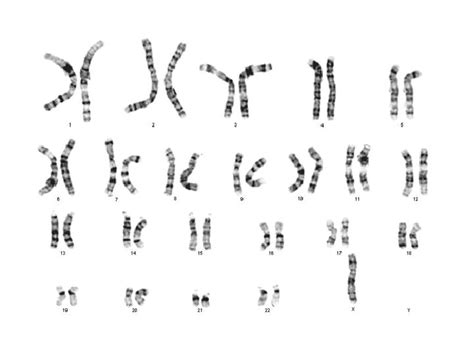 Sex Chromosomes And Abnormalities Sex Chromosomes At The