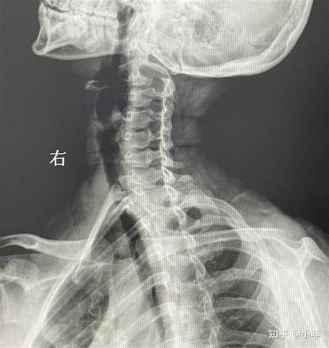 经常加班颈椎腰椎不舒服该如何缓解颈椎按摩仪是智商税吗内附提高幸福感的办公室好物推荐 知乎