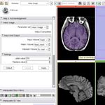 Slicer3 Registration Slicer Wiki