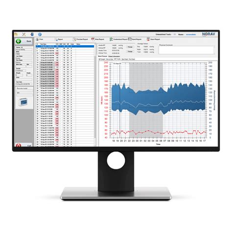 Nems A Ecg Management System Norav Medical