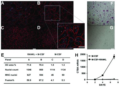Human Cd14 Mononuclear Cells Form Multinucleated Giant Cells Mnc Download Scientific Diagram