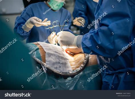 Classic Cesarean Section Operating Theater Labor Foto De Stock 1548176843 Shutterstock