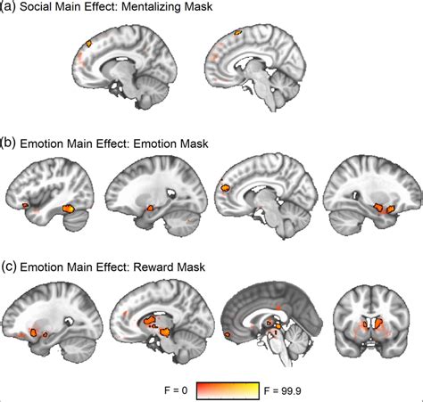 Anova Main Effect Result Maps From The Time‐averaged Glm Data Download Scientific Diagram