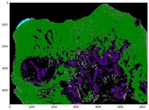 Color Thresholding Semantic Segmentation — Histomicstk 0 1 0 Documentation