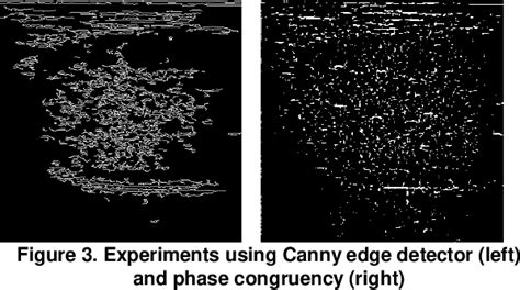 Figure 3 From Automatic Detection Of Liver Capsule Using Gabor Filters Applications In