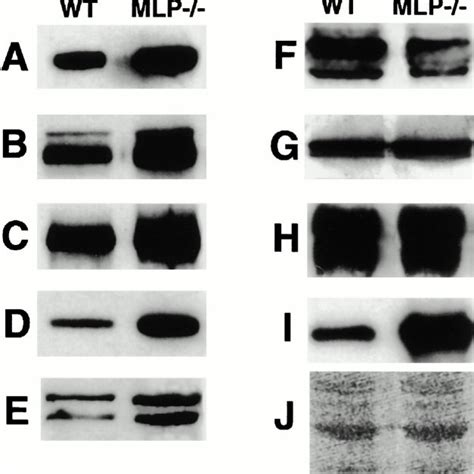 Electron Microscopy Of The Altered Intercalated Disk Morphology In
