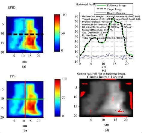 Plan Based Calibration For Epid A Measured Fluence Map For Imrt Download Scientific Diagram