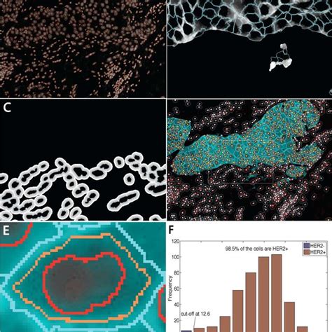 Flowchart Outlining The Main Steps Of The Proposed Nuclear Segmentation Download Scientific
