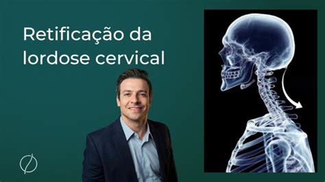 Retificação Da Curvatura Cervical Fisiológica Causas E Soluções