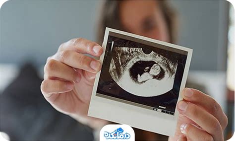 تفاوت جنین دختر و پسر در سونوگرافی چیست؟ بهترین زمان تشخیص