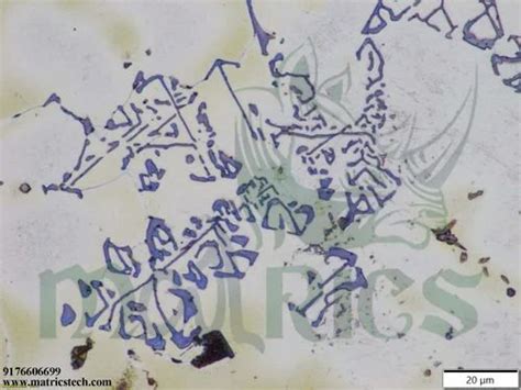 Microstructure Optical Microscopy Micro Graph In Kanyakumari Id