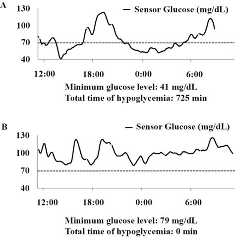 Repeated Hypoglycemic Episodes With Postprandial Hyperinsulinemia After