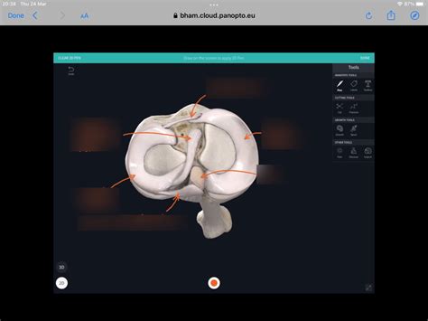 Diagram Of Mjm Week 8 Knee Quizlet