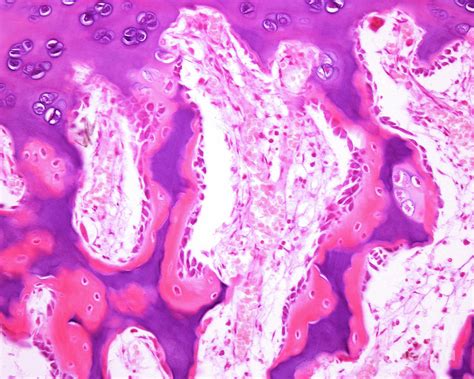 Endochondral Ossification Photograph By Jose Calvo Science Photo Library Pixels