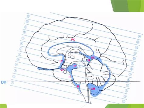 Basal Cisterns Finalppt