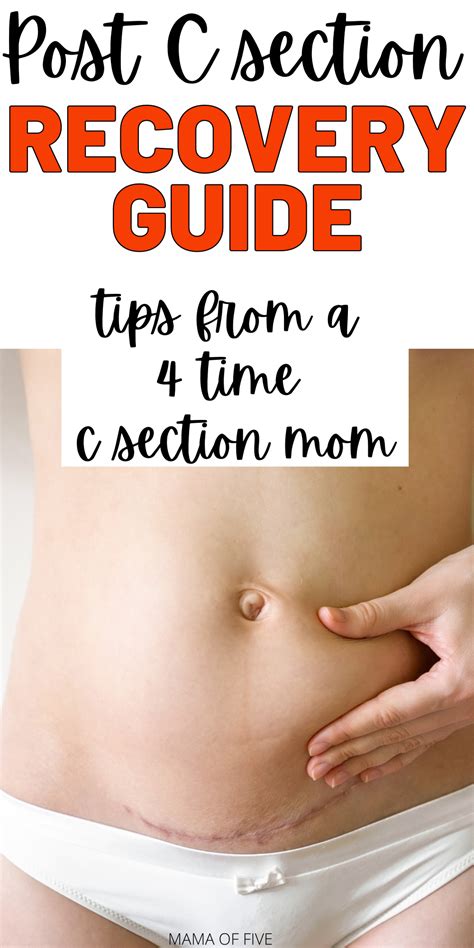 Csection Recovery Guide Artofit