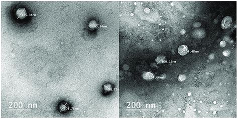 Tem Images Of Intracellular And Extracellular Distribution Of Download Scientific Diagram