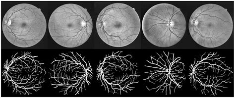 Github Deeptrial Retina Vesselnet A Simple U Net Model For Retinal Blood Vessel Segmentation