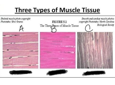 Lab Exam Flashcards Quizlet