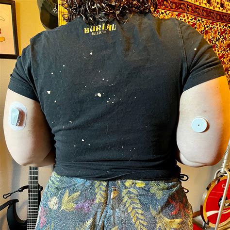 Currently Wearing Both A Freestyle Libre 2 And A Dexcom G6 To See How