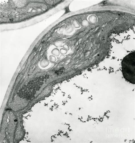 Chloroplast Micrograph