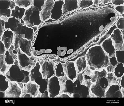 Scanning Electron Micrograph Sem Of Photocomposite Of Bacillus Anthracis Spores In Lung