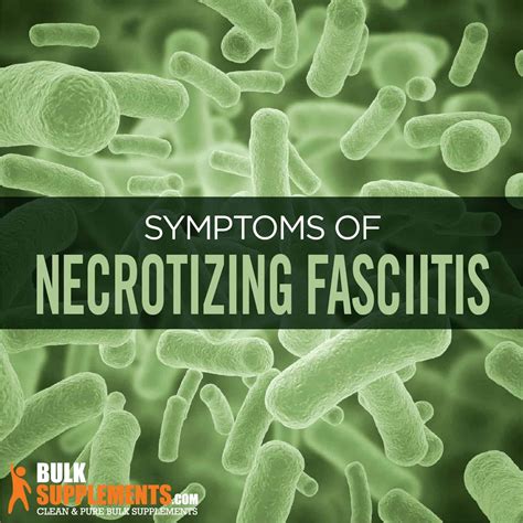 Necrotizing Fasciitis Bacteria Necrotizing Fasciitis Flesh Eating Bacteria Youtube