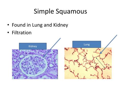 PPT Simple Squamous PowerPoint Presentation Free Download ID