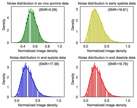 Node2node Self Supervised Cardiac Diffusion Tensor Image Denoising Method