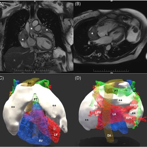 En Bloc Tumor Resection A External Surface View And B Internal Download Scientific Diagram