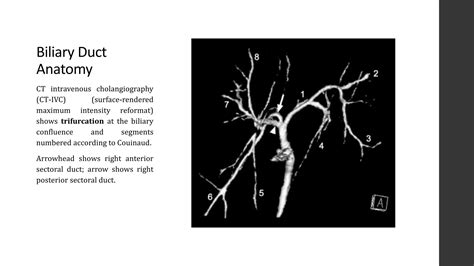 Imaging Of The Biliary System And Its Disorders Pptx