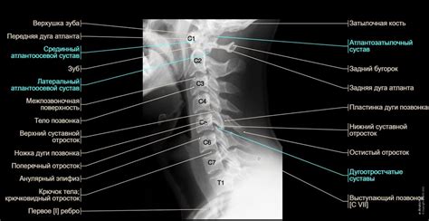 Позвоночник рентгенограммы нормальная анатомия E Anatomy