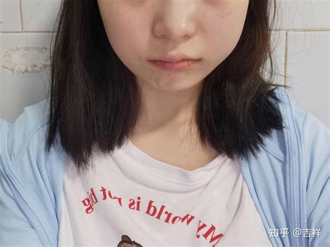 我的拔智齿经历 知乎