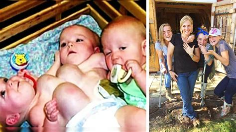 Conjoined Twins Proved Happiness Knows No Bounds In Their Teenage Years