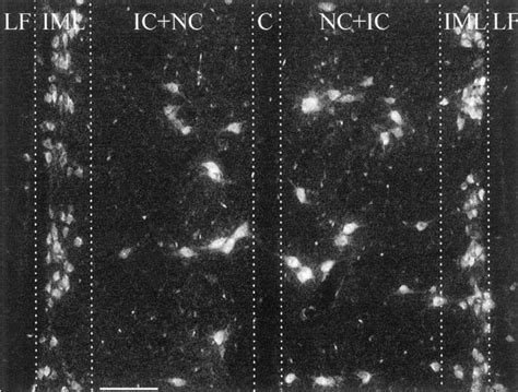 Identification Of Preganglionic Sympathetic Neurons In The Spinal Cord Download Scientific