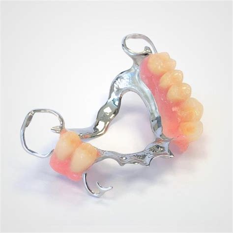 Partial Dentures Upper Or Lower Acrylic Flexible Chrome The Denture Clinic Newport