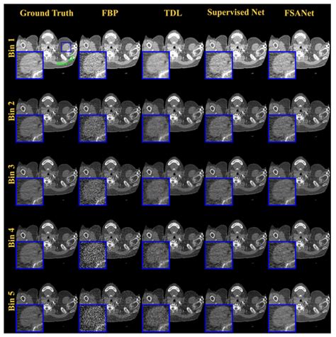 Full Spectrum Knowledge Aware Unsupervised Network For Photon Counting Ct Imaging