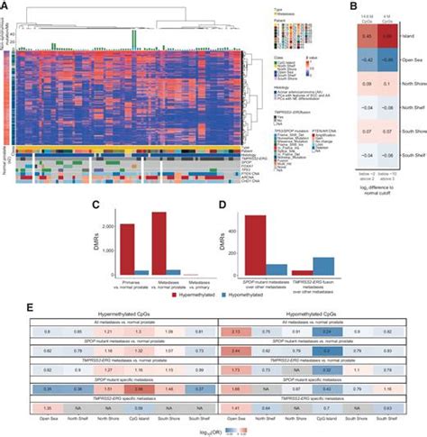 Dna Methylation Landscapes Of Prostate Cancer Brain Metastasis Are Shaped By Early Driver