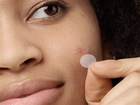 Wake Up To Clear Skin 7 Proven Hacks On How To Get Rid Of Pimples Overnight Leap With Grace