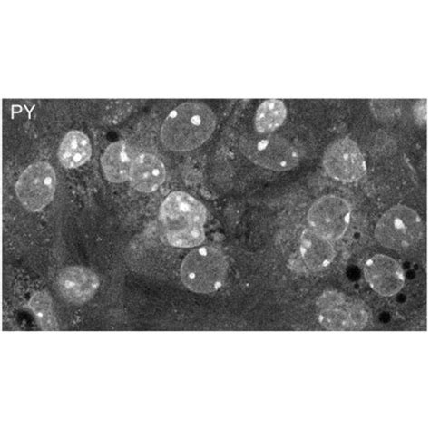 Pyronin Y Pyronine G Cationic Dye Medchemexpress