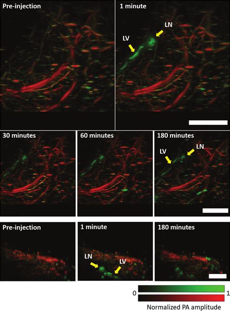 Long Duration Photoacoustic Imaging Of Deep Lymphatic Vessels In Mouse Download Scientific