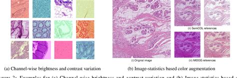 Multi Task Learning For Tissue Segmentation And Tumor Detection In